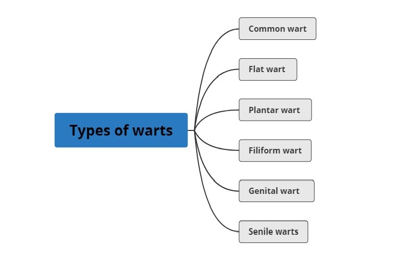 Everything You Need to Know About Warts - Med Warts